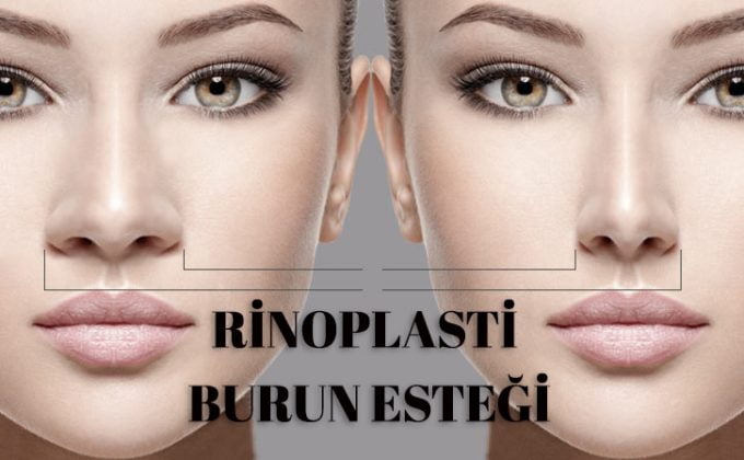 Burun Estetiği, Rinoplasti, Burun Estetiği Ameliyatı konya
